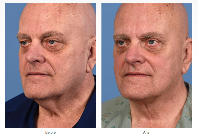 Face Forward: 3 Areas Men Focus On | Jeffrey Kenkel, MD