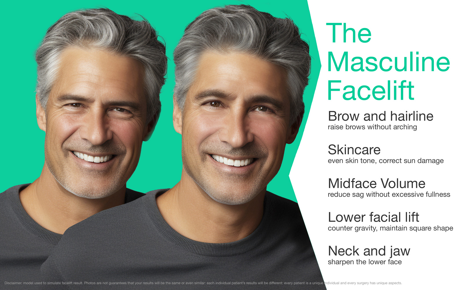 How Are Male Facelifts Different? Exploring Facial Rejuvenation Options ...